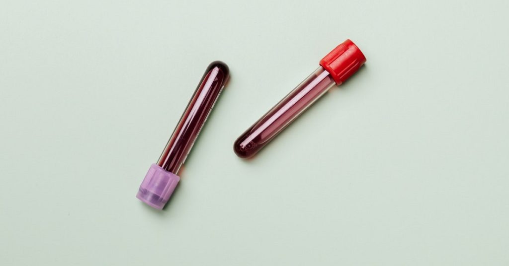 Blood Testing Edinburgh - Get Your Blood Tested At Newington Pharmacy