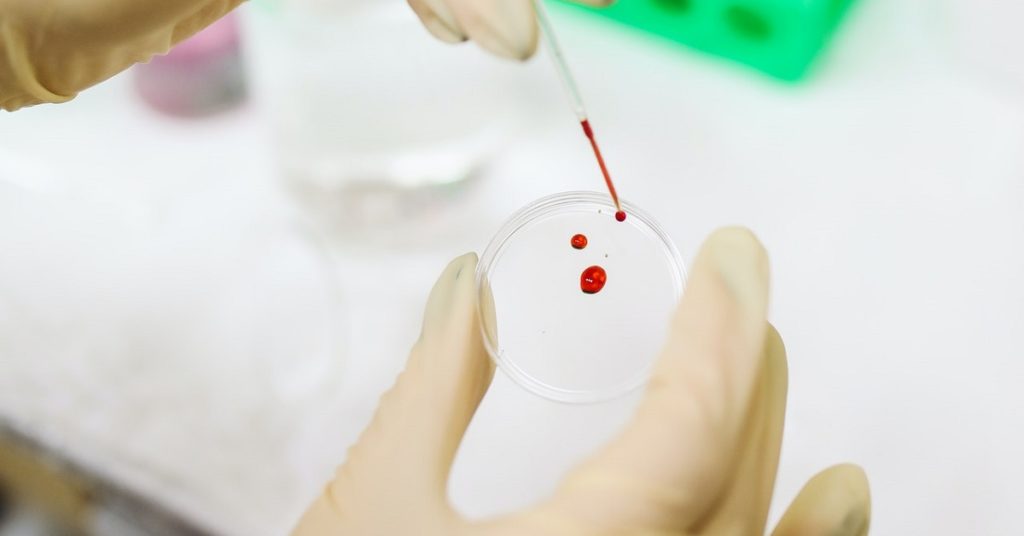 Blood Testing Edinburgh - Get Your Blood Tested At Newington Pharmacy