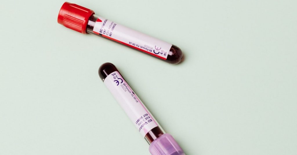 Blood Testing Edinburgh - Get Your Blood Tested At Newington Pharmacy